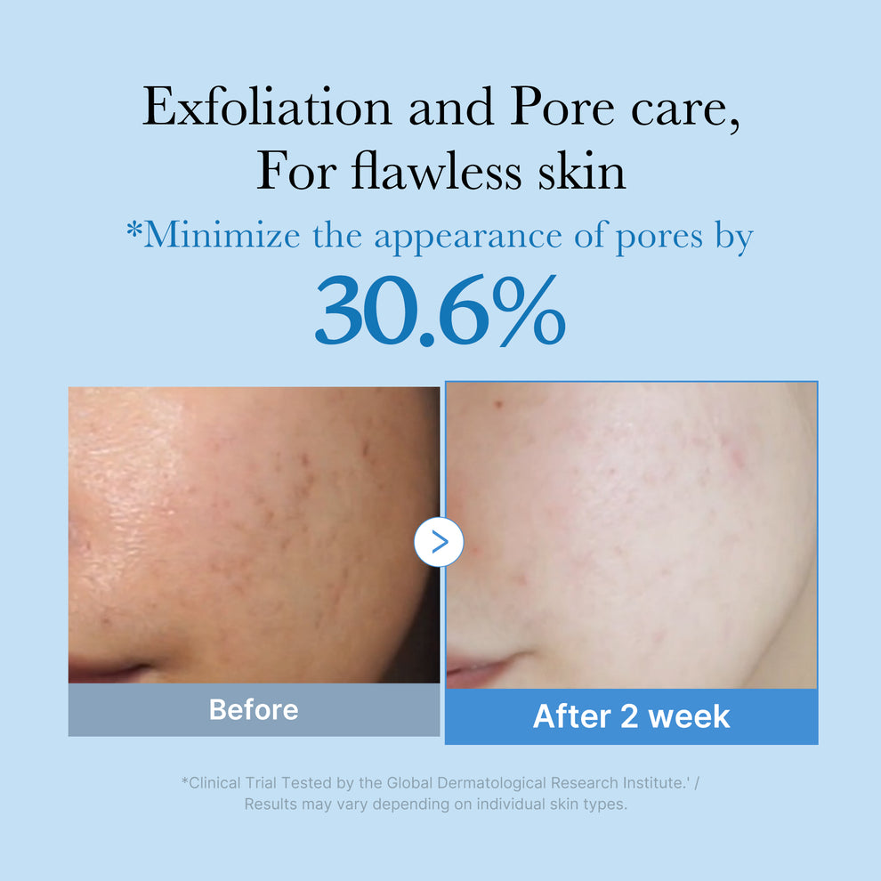 Zero Pore Toner – MEDICUBE SG
